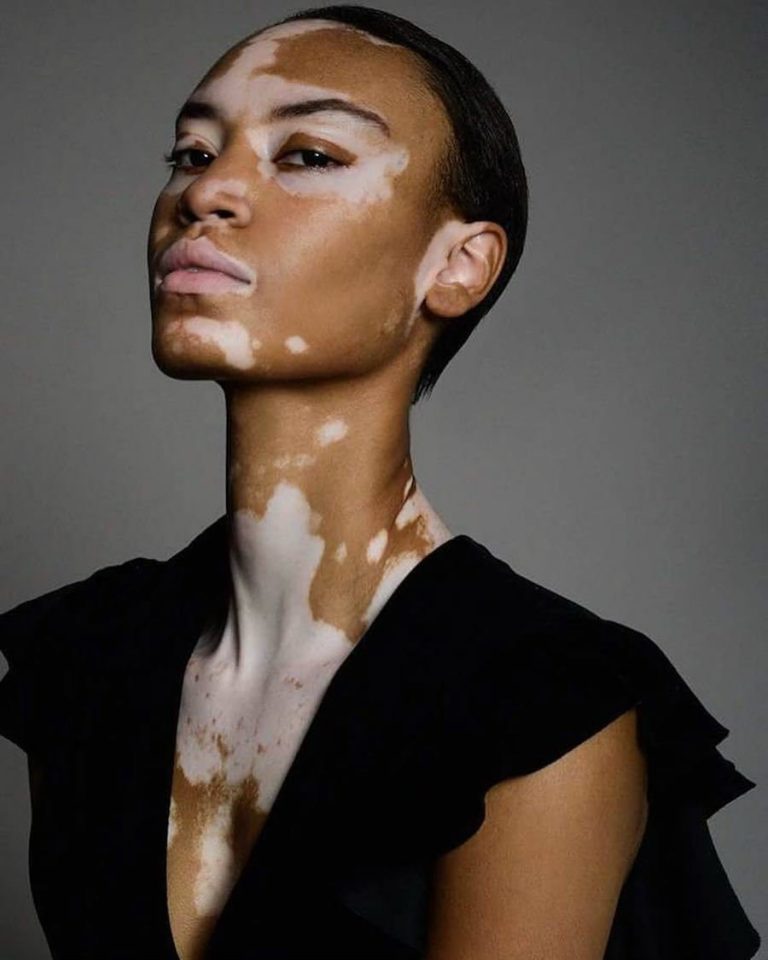 Top Inclusive Beauty Ads that Make a Difference - Unlimited Graphic ...
